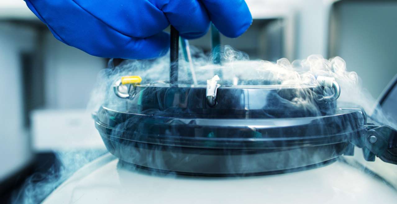 Congelación de Esperma | Clínica Miraflores | Ginecología y Fertilidad